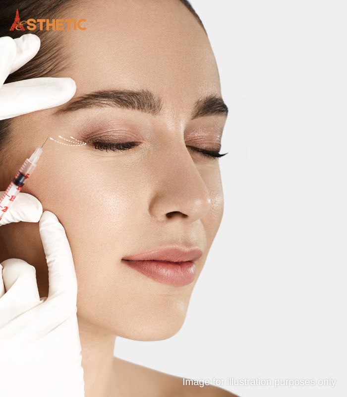 Crow’s Feet Treatment - AE Aesthetic Medi Specialist